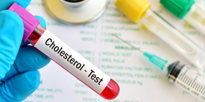 کلسترول چیست ؟ و چه عواملی باعث کلسترول بالا می شوند ؟ پارسی طب